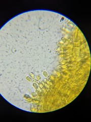 Spider Akanthomyces (Akanthomyces aranearum) | Mushrooms of Nebraska