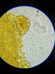 Spider Akanthomyces (Akanthomyces aranearum) | Mushrooms of Nebraska