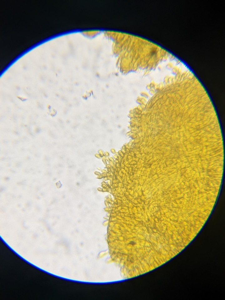 Spider Akanthomyces (Akanthomyces aranearum) | Mushrooms of Nebraska